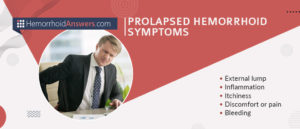 Prolapsed Hemorrhoids – HemorrhoidAnswers